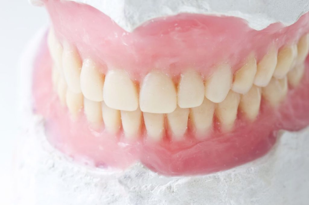 O QUE SÃO PRÓTESES DENTÁRIAS E COMO FUNCIONAM