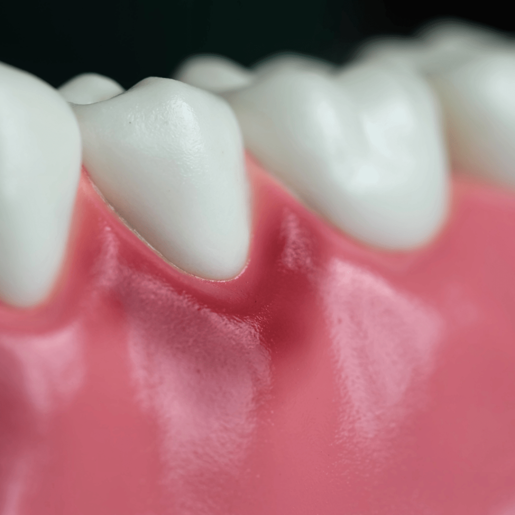 Periodontia: entenda melhor sobre essa área da odontologia